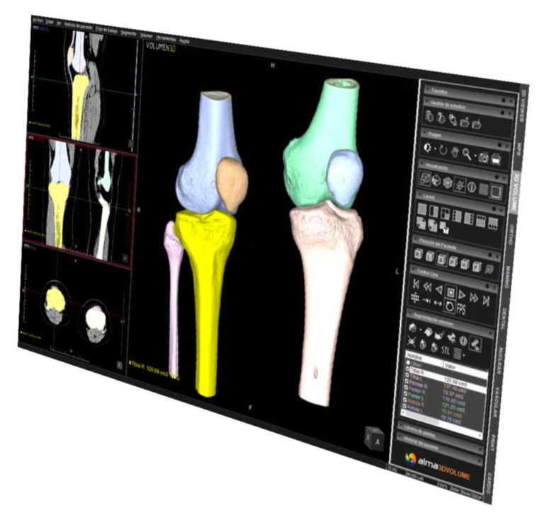 Alma 3d Dicomdata 